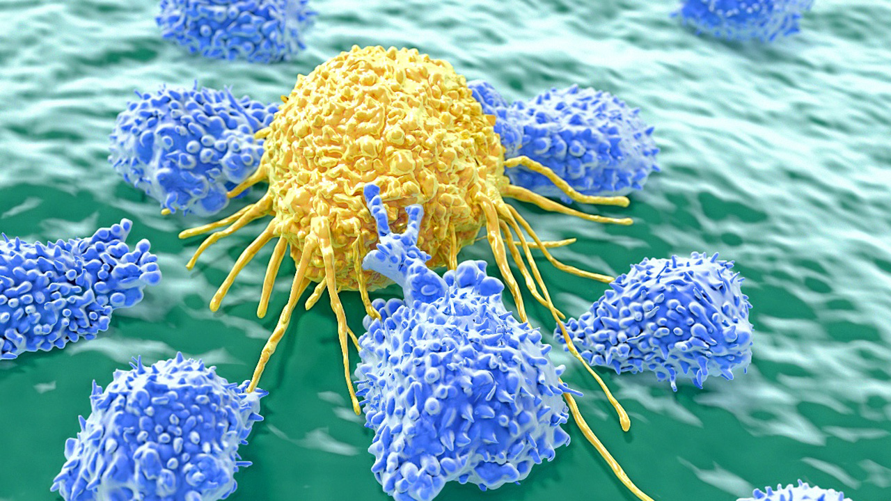 KIRby para combatir el cáncer de páncreas. – Linfocitos infiltrados