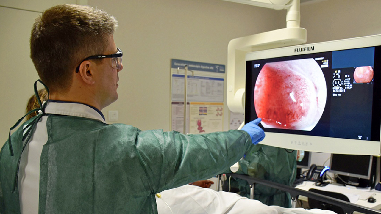 Evalúan técnicas de endoscopia para identificar mejor el cáncer ...
