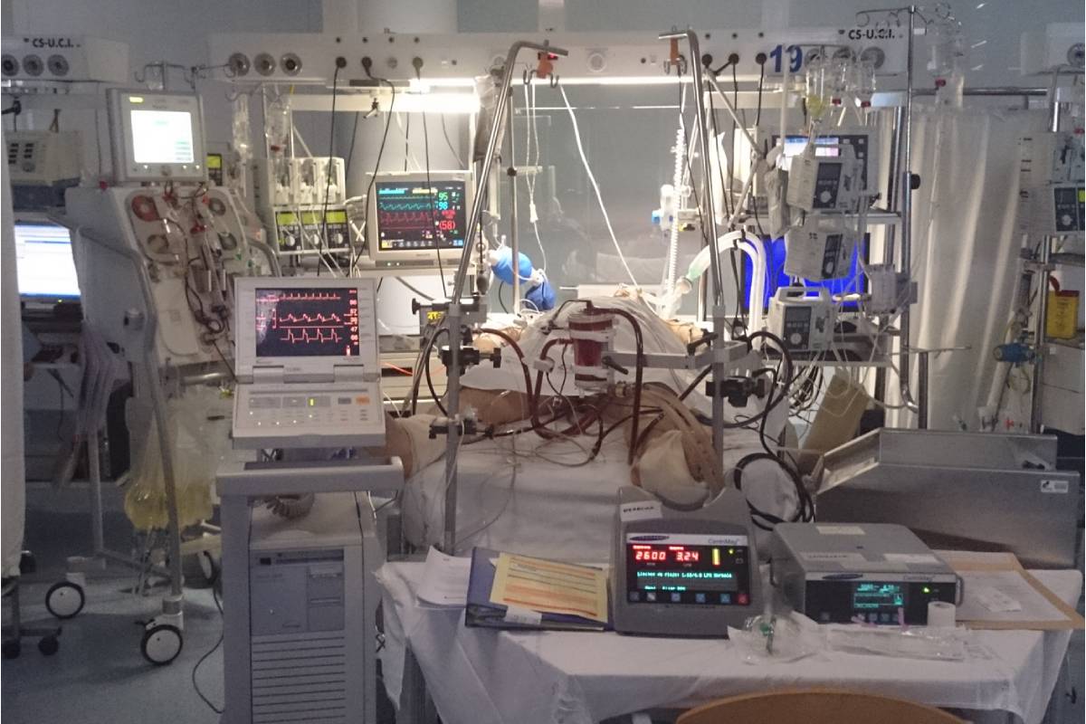 Neumonía asociada a ventilación, sobreinfección en covid-19 grave