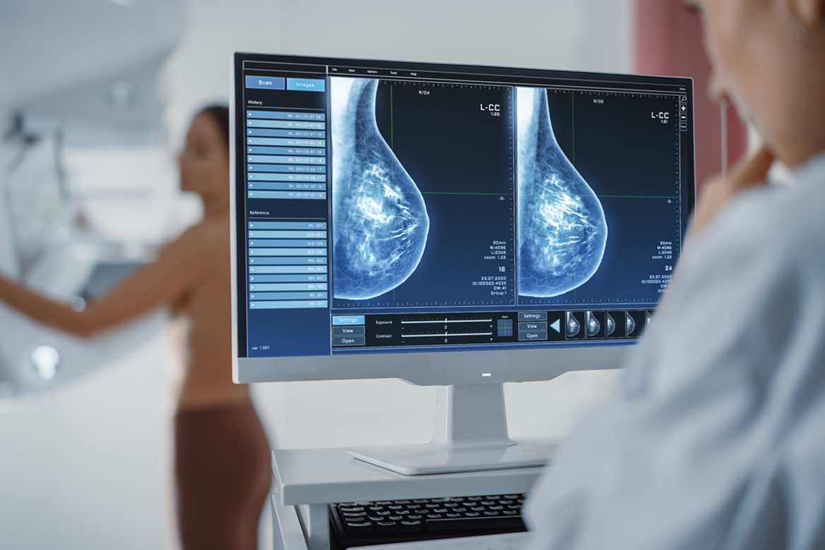 Nuevos resultados demuestran el beneficio sostenido de abemaciclib más ...