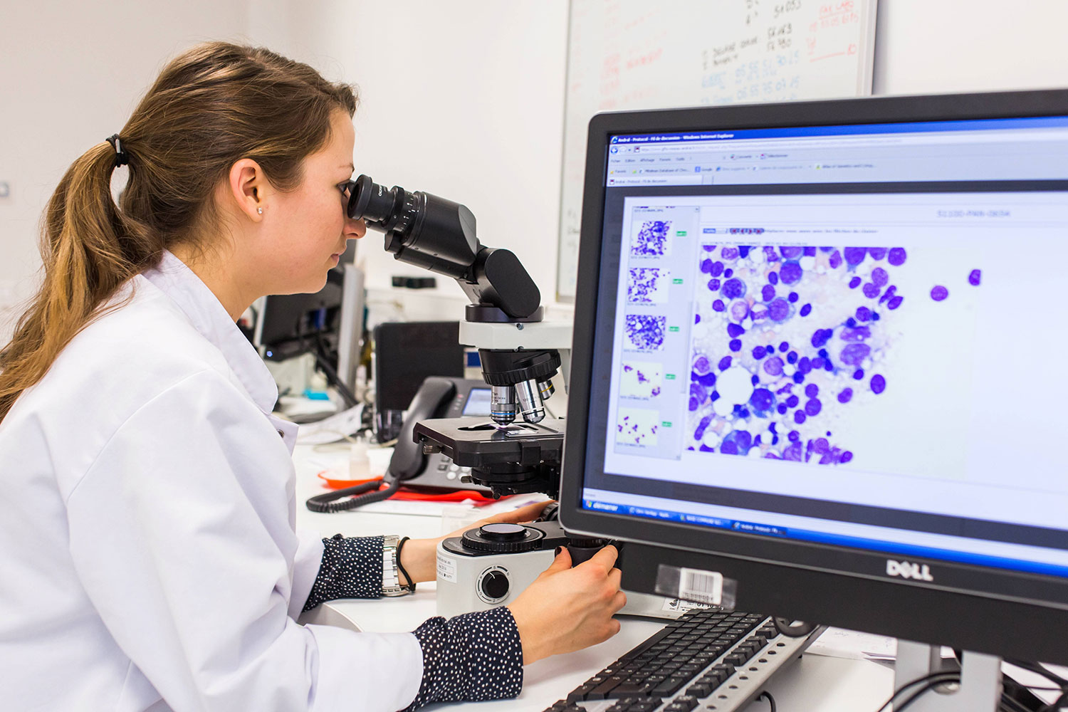 La CE aprueba 'Tepkinly', de AbbVie y Genmab, en linfoma folicular ...