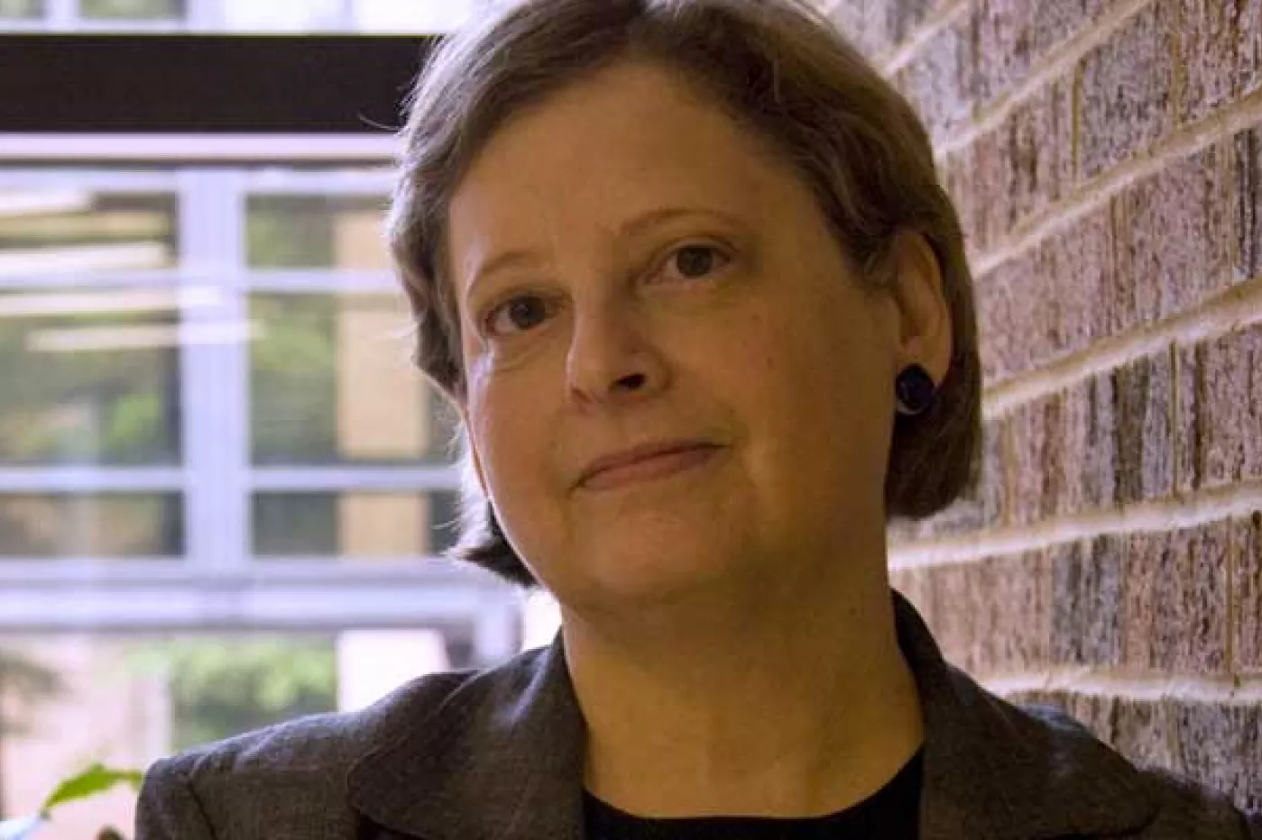 Más lesiones cerebelosas en mujeres con migraña con aura | DiarioMedico