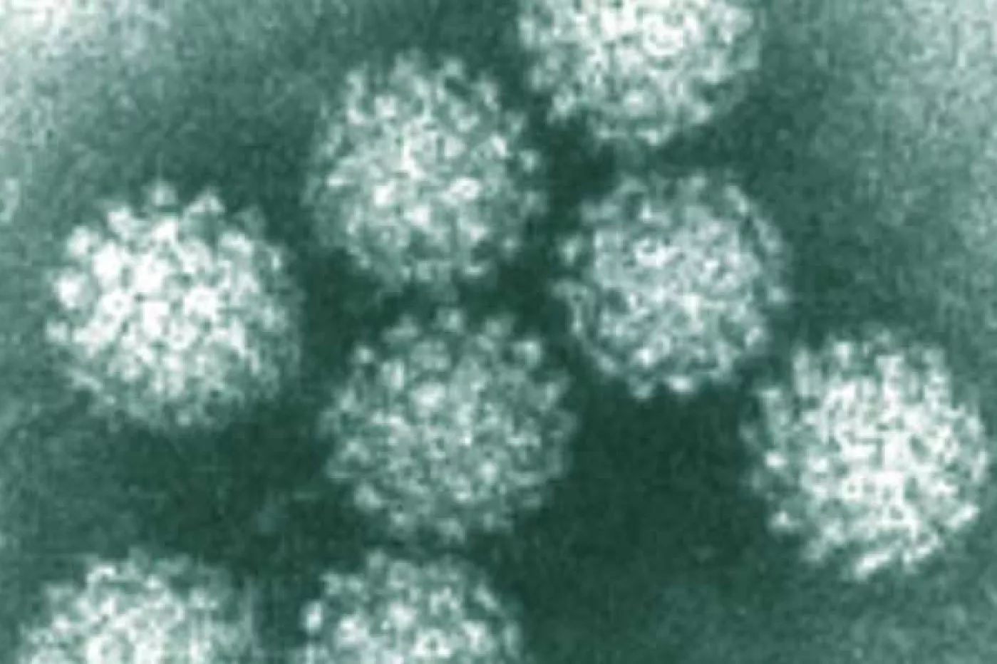 La terapia antirretroviral reduce un 20% el riesgo de infección por VPH ...