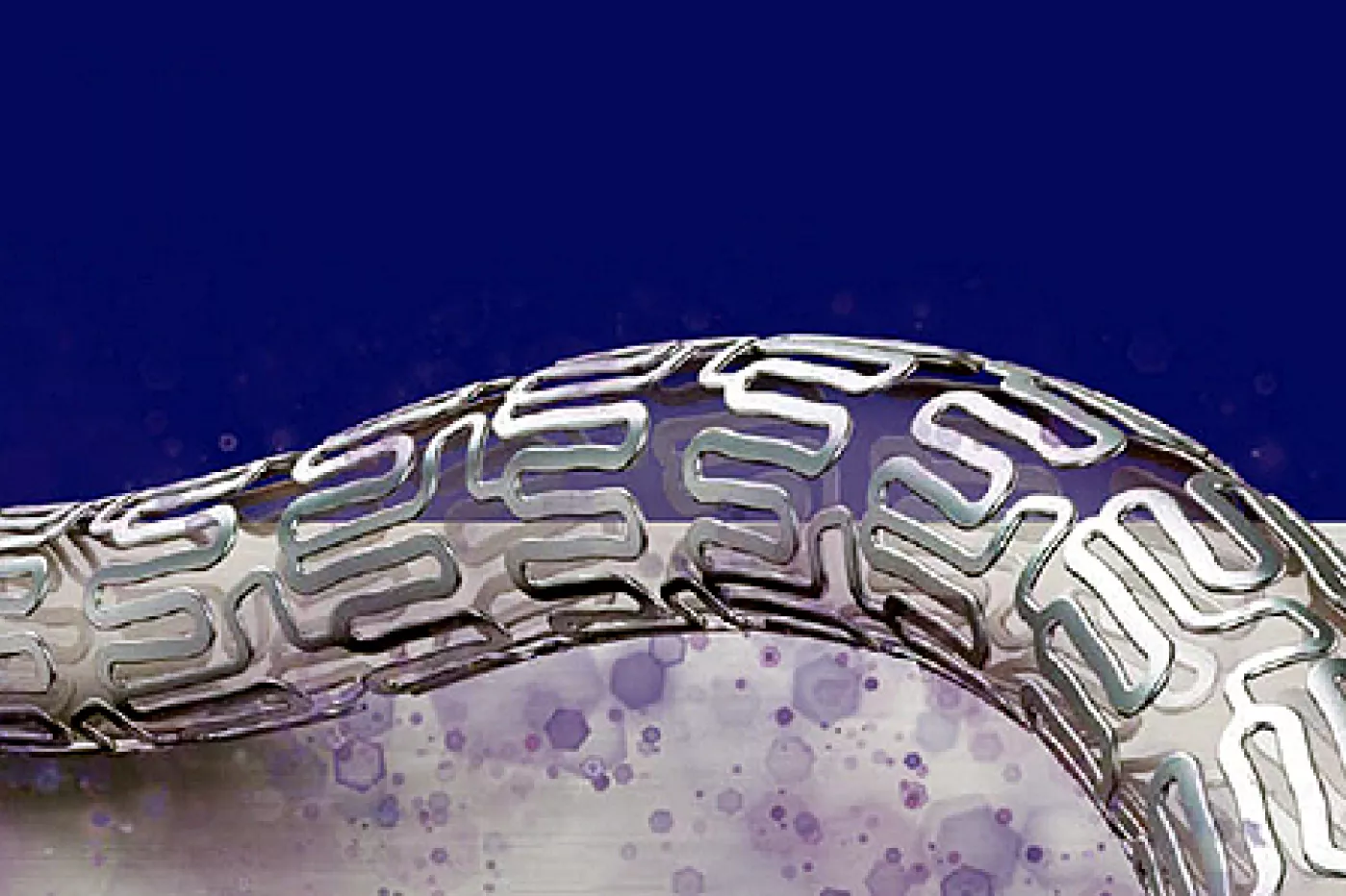 Cambios en el diseño para un 'stent' más eficaz | DiarioMedico