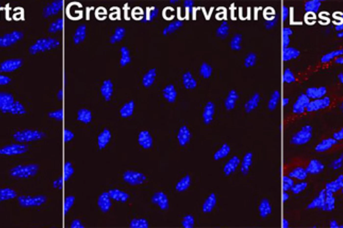 Identifican un gen clave en la respuesta inflamatoria de las células al ...