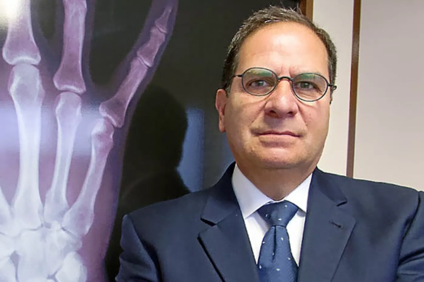 El ACA, solución en pacientes con alto riesgo de luxación de cadera ...