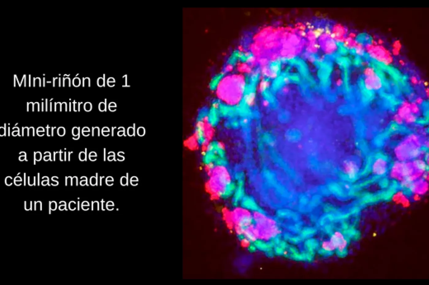 Los organoides alcanzan la madurez como modelos de enfermedades ...