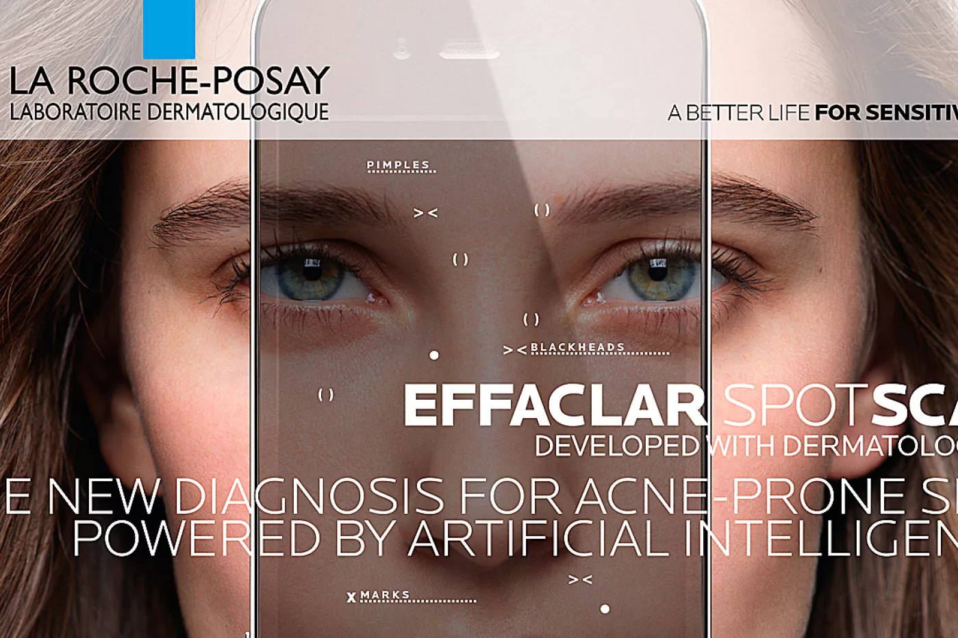 Una 'app' permite hacer análisis de la piel con acné | DiarioMedico